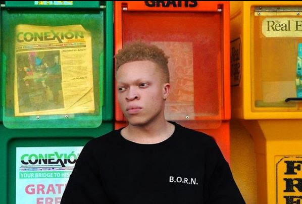 20-Year-Old Musician With Albinism Has Big Plans To Inspire Change